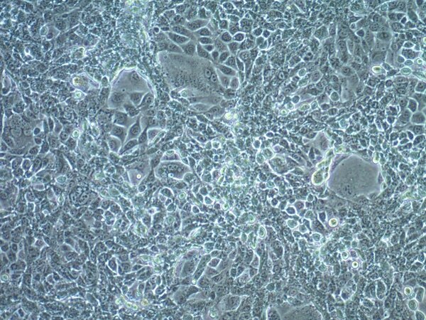 ID8 Mouse Ovarian Surface Epithelial Cell Line | SCC145
